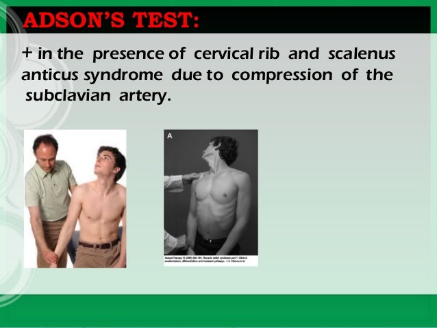 perpheral vascular disease & gangrene examination