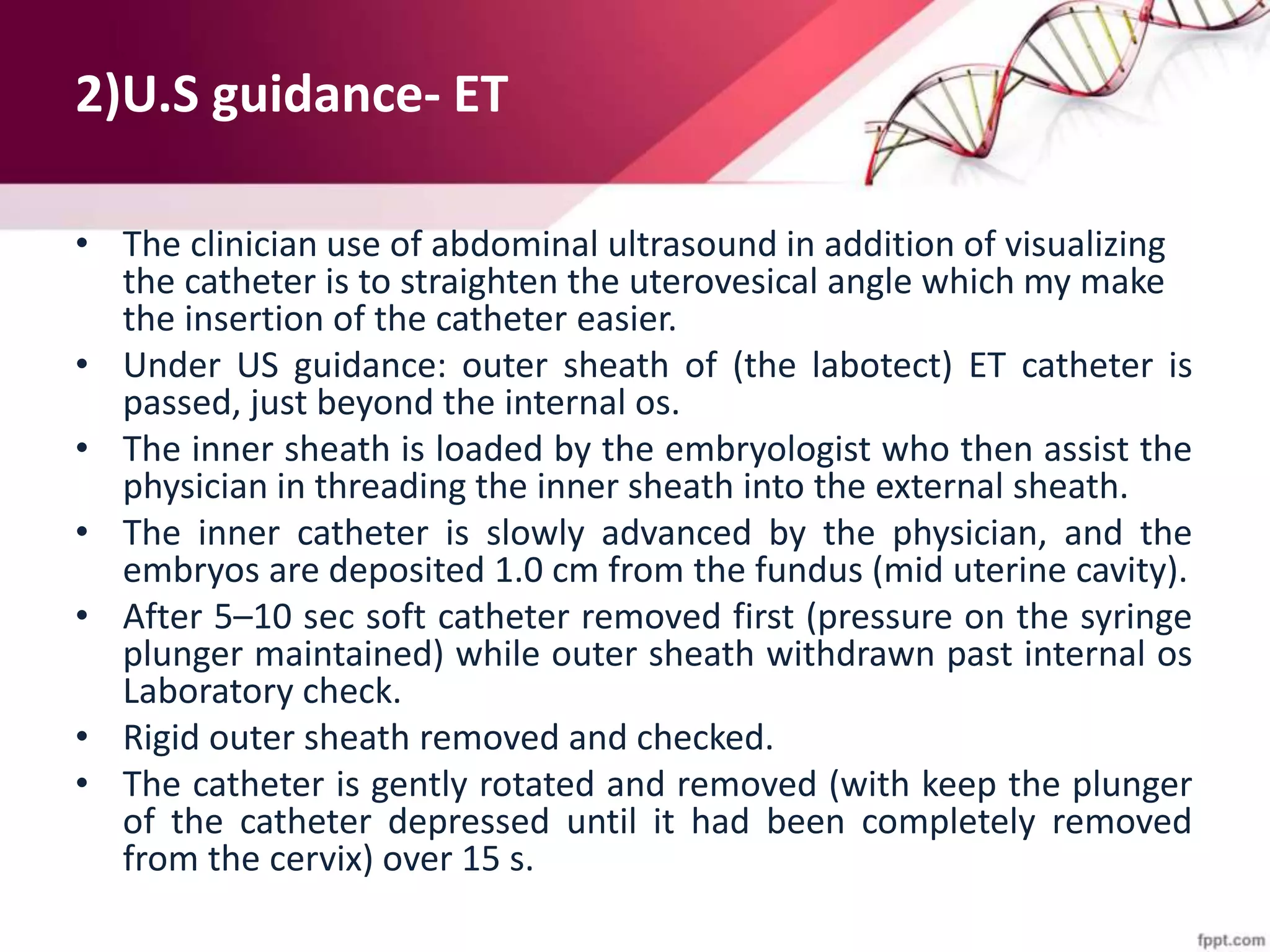 INVITRO FERTILIZATION - EMBRYO TRANSFER | PPTX