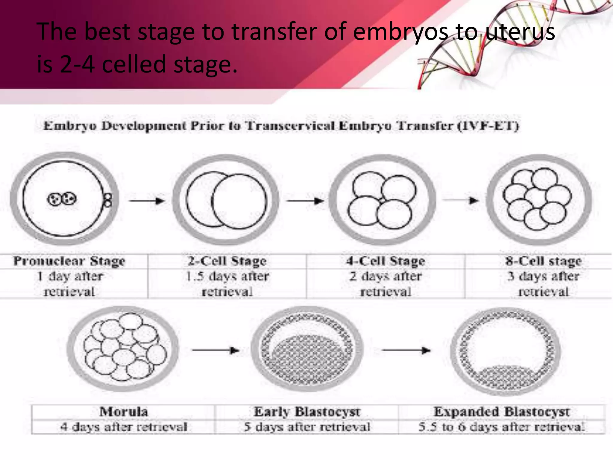 INVITRO FERTILIZATION - EMBRYO TRANSFER | PPTX
