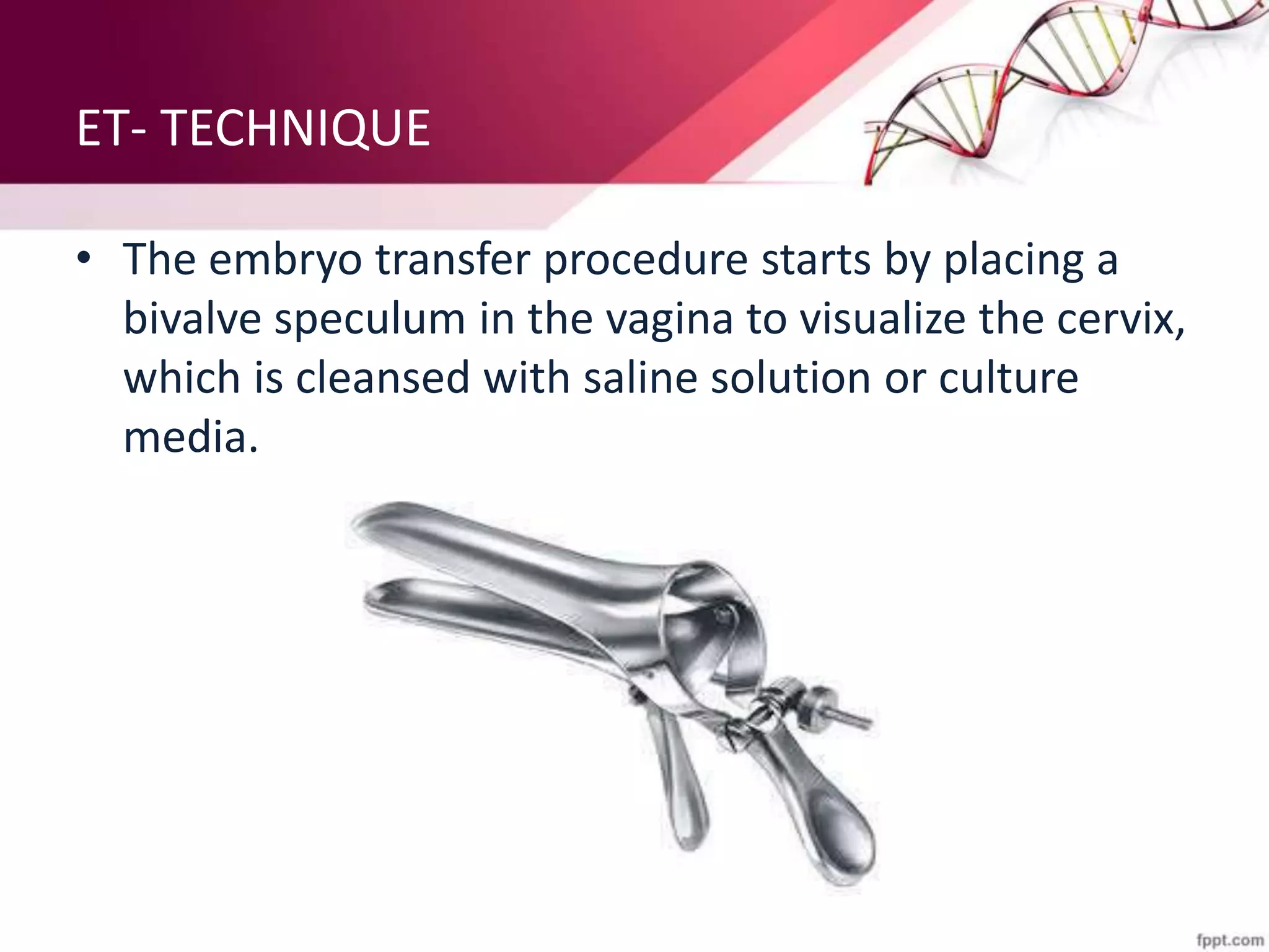 INVITRO FERTILIZATION - EMBRYO TRANSFER | PPTX
