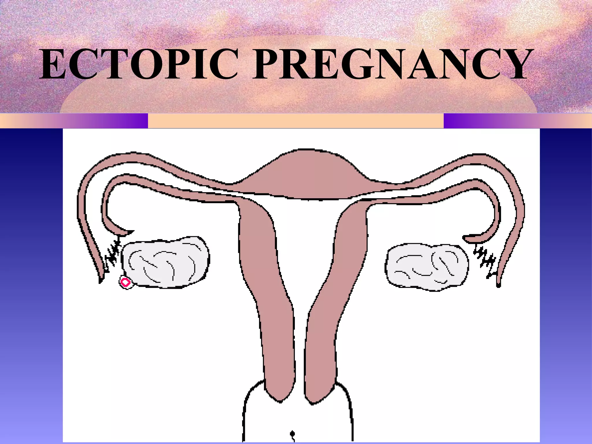 BIOLOGY FORM 5 CHAPTER 4 - 4.1E FERTILISATION & DEVELOPMENT | PPT | Infertility | Reproductive ...
