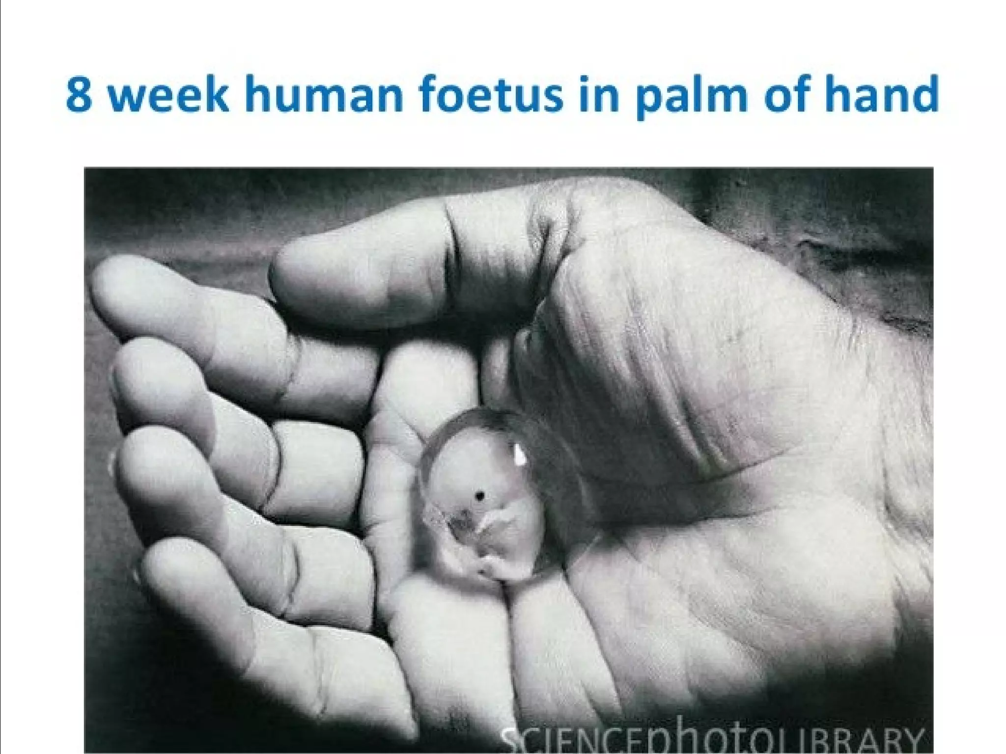 BIOLOGY FORM 5 CHAPTER 4 - 4.1E FERTILISATION & DEVELOPMENT | PPT | Infertility | Reproductive ...