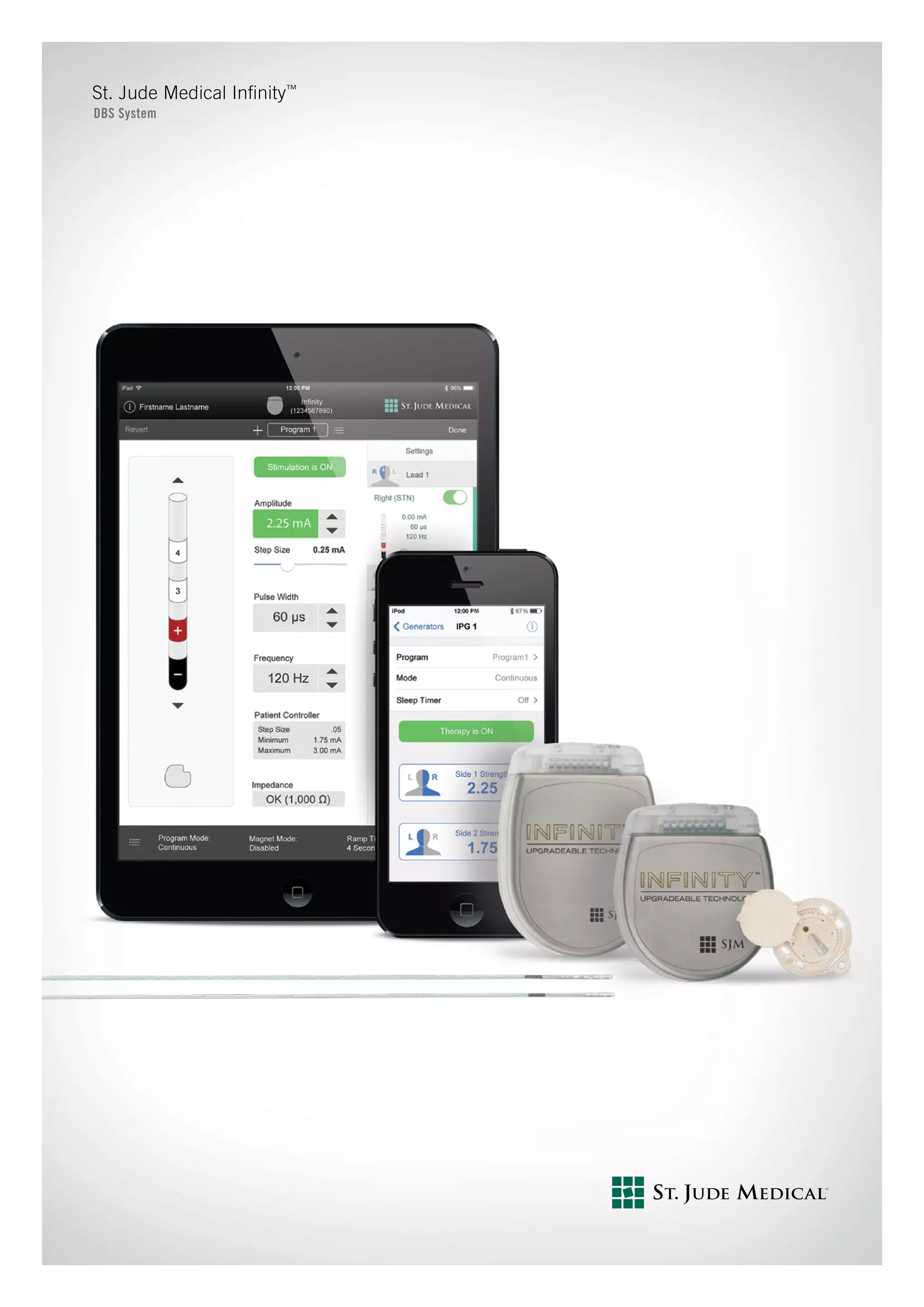 Infinity DBS System | PDF