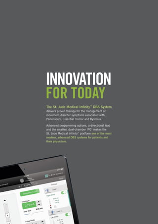 Infinity DBS System | PDF