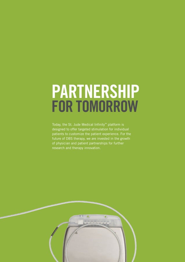 Infinity DBS System | PDF