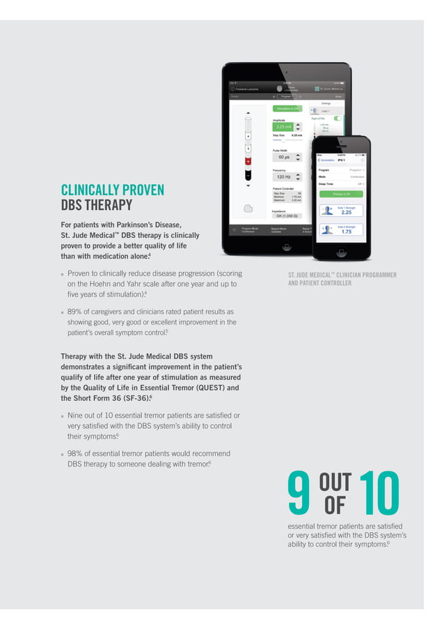 Infinity DBS System | PDF