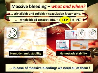 1 ffp octaplas massive transfusion 35 slides | PPT