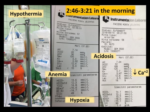 1 ffp octaplas massive transfusion 35 slides | PPT