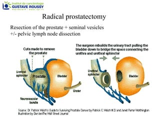 MON 2011 - Slide 1 - K. Fizazi - Spotlight session - New developments ...