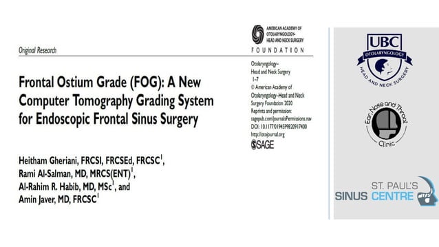 Award-winning New CT grading system for preoperative Endoscopic Frontal ...