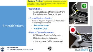 Award-winning New CT grading system for preoperative Endoscopic Frontal ...
