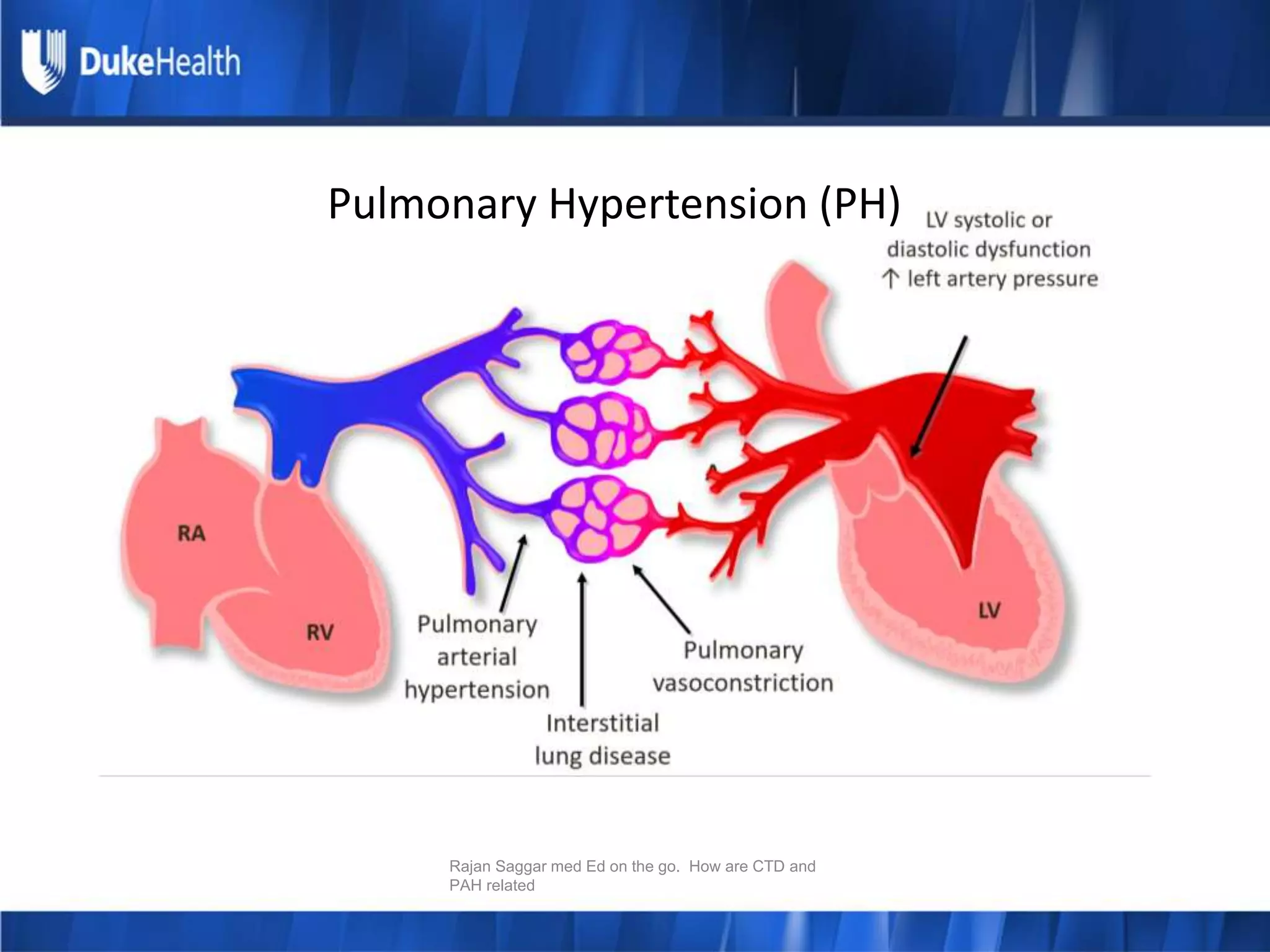 Pulmonary Hypertension Basics 2021 | PPTX