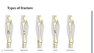 The fractures in the children and the types | PPTX