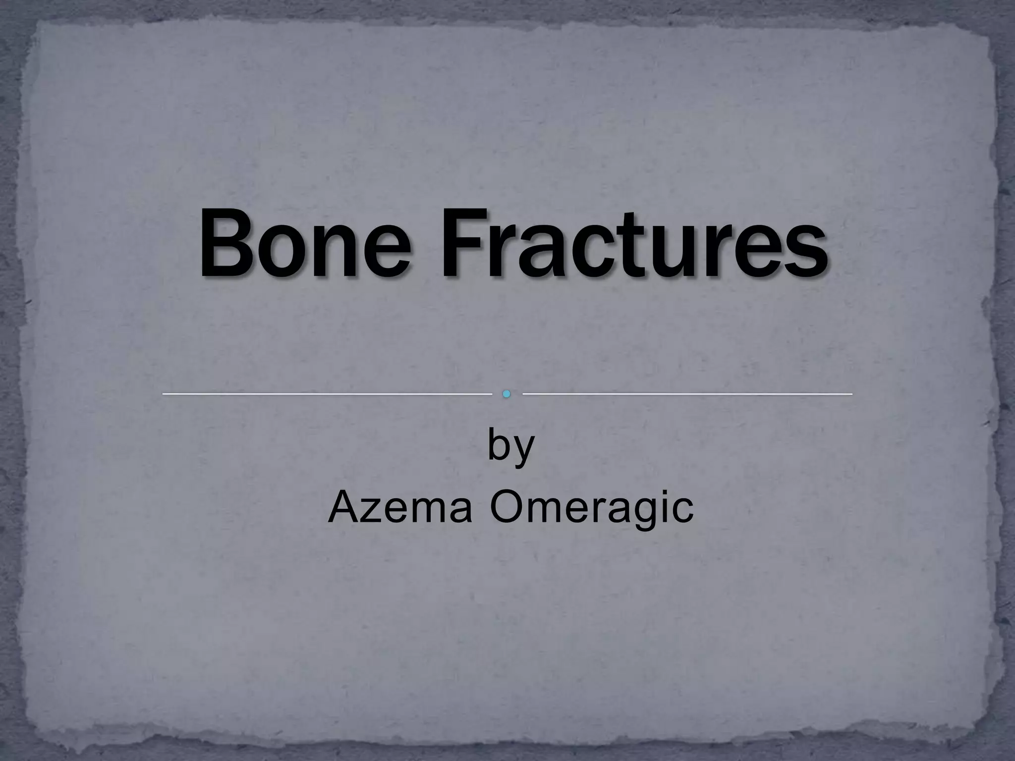 3 bone fractures | PPT