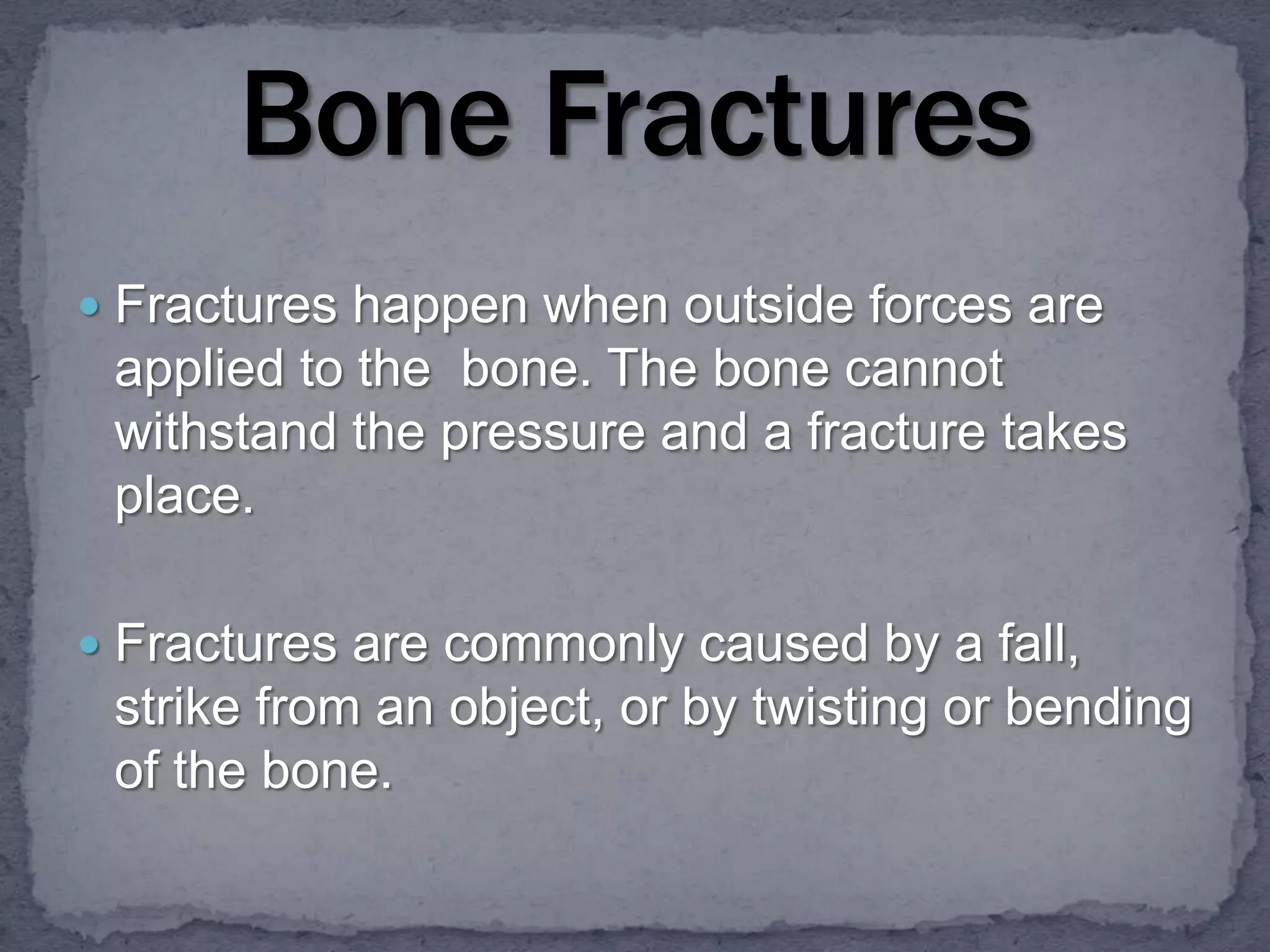 3 bone fractures | PPT