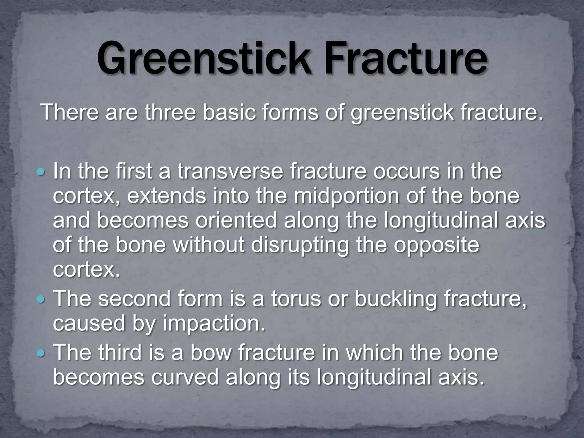 3 bone fractures | PPT