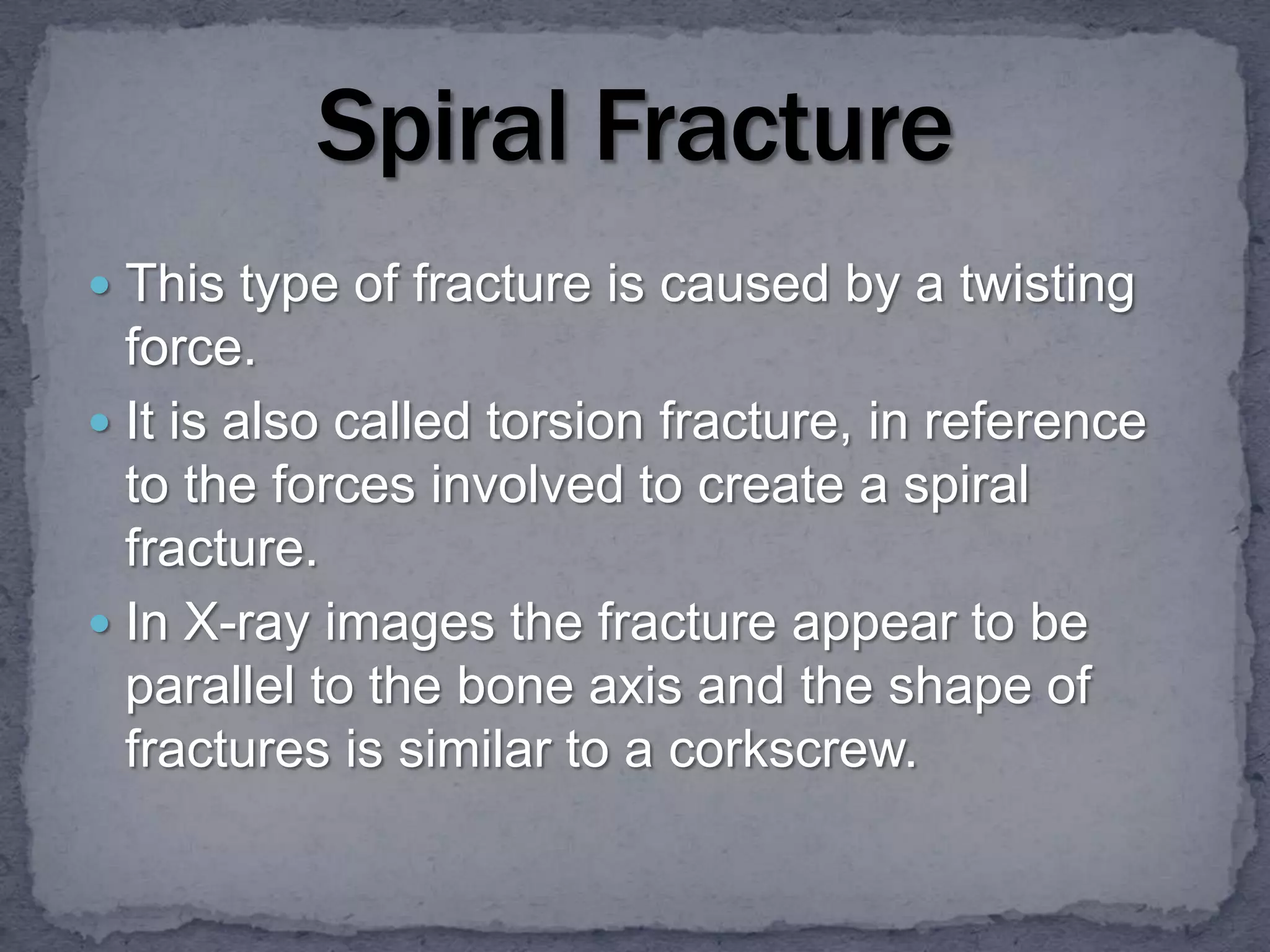 3 bone fractures | PPT