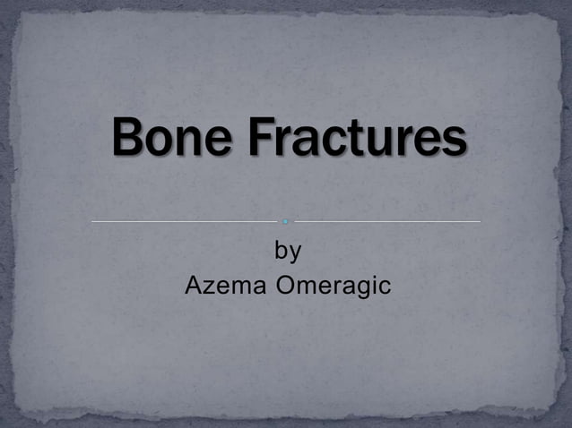 3 bone fractures | PPT