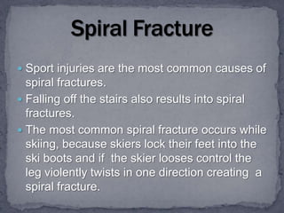 3 bone fractures | PPTX