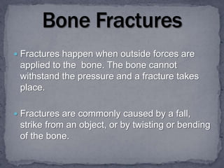 3 bone fractures | PPT
