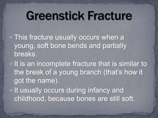 3 bone fractures | PPT