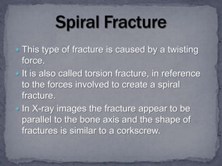3 bone fractures | PPTX