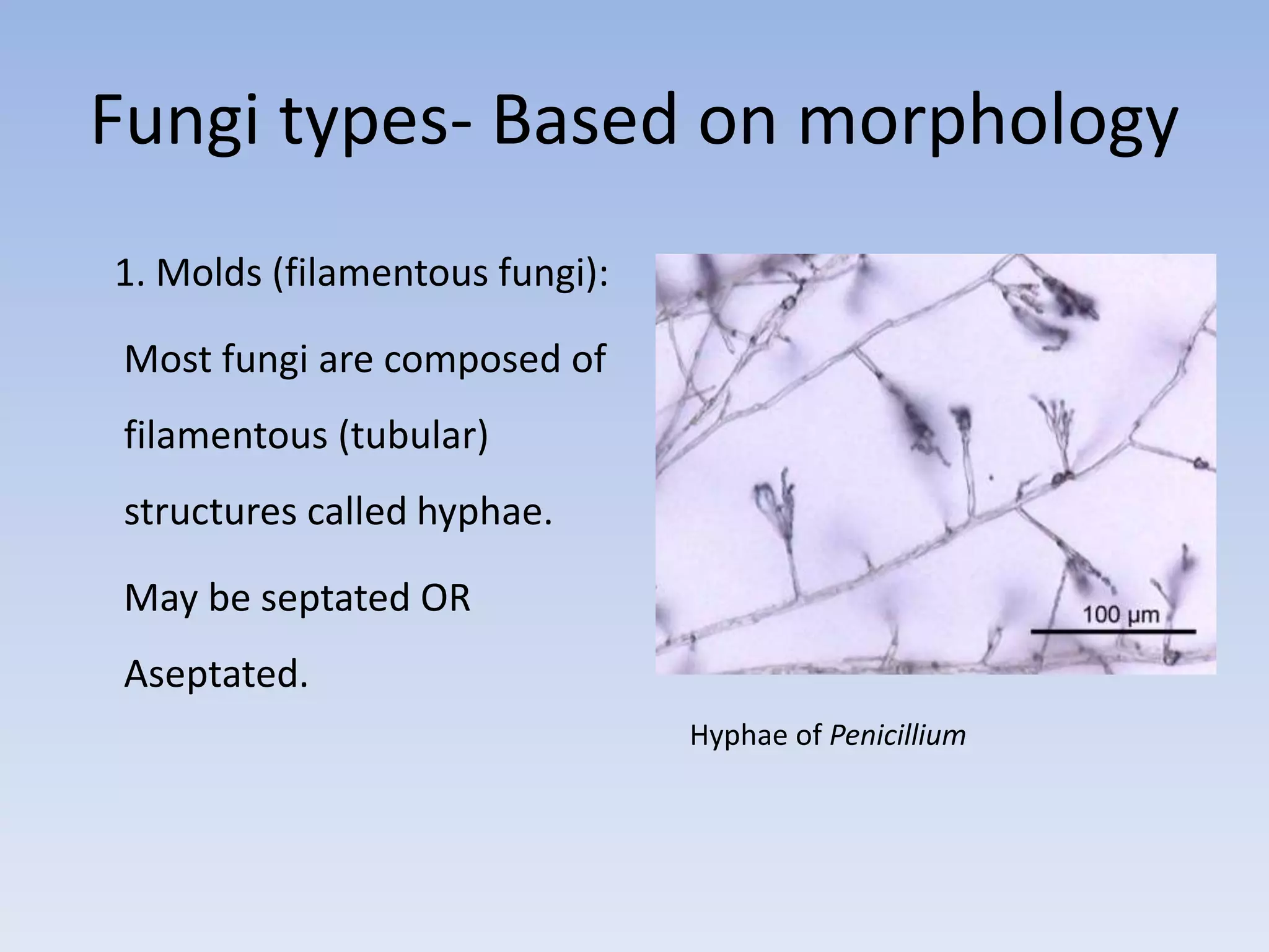 1 FUNGAL DISEASES OF ORAL CAVITY.pptx