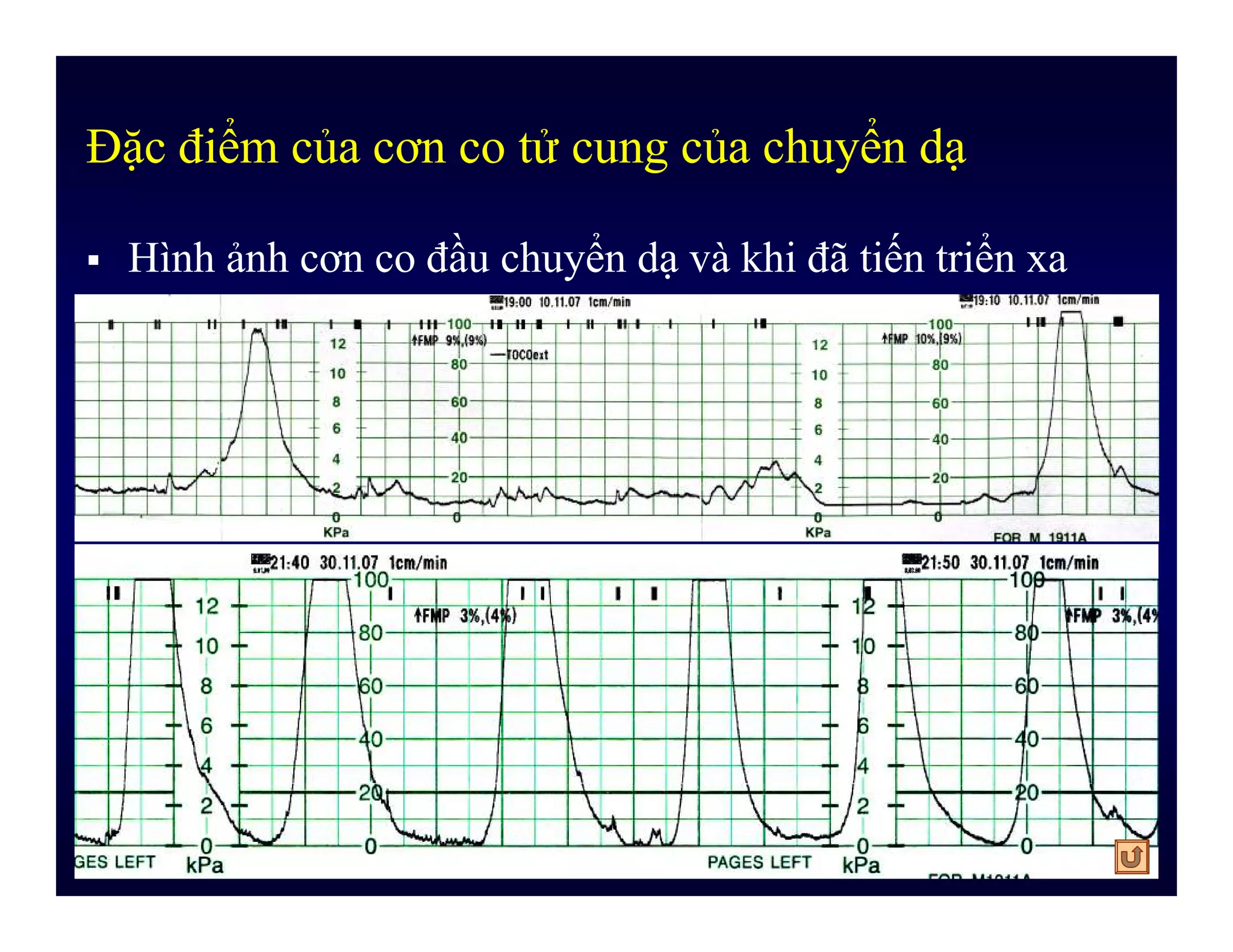SINH LÝ CHUYỂN DẠ | PDF