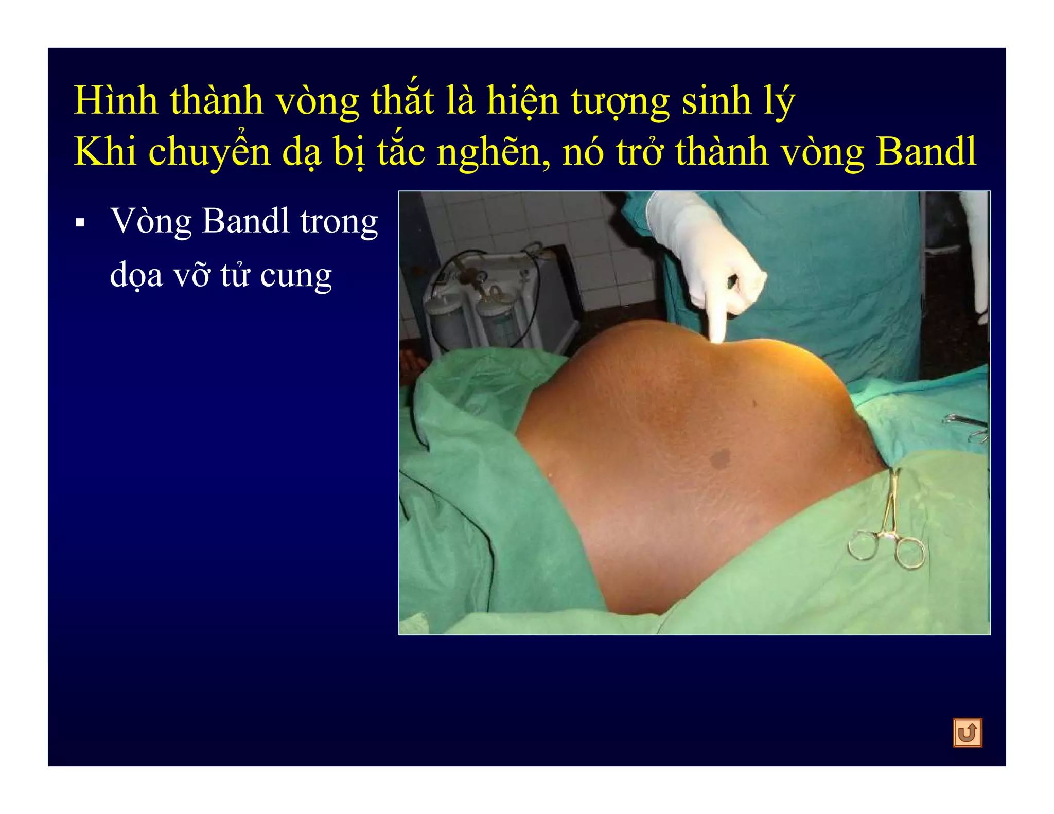 SINH LÝ CHUYỂN DẠ | PDF