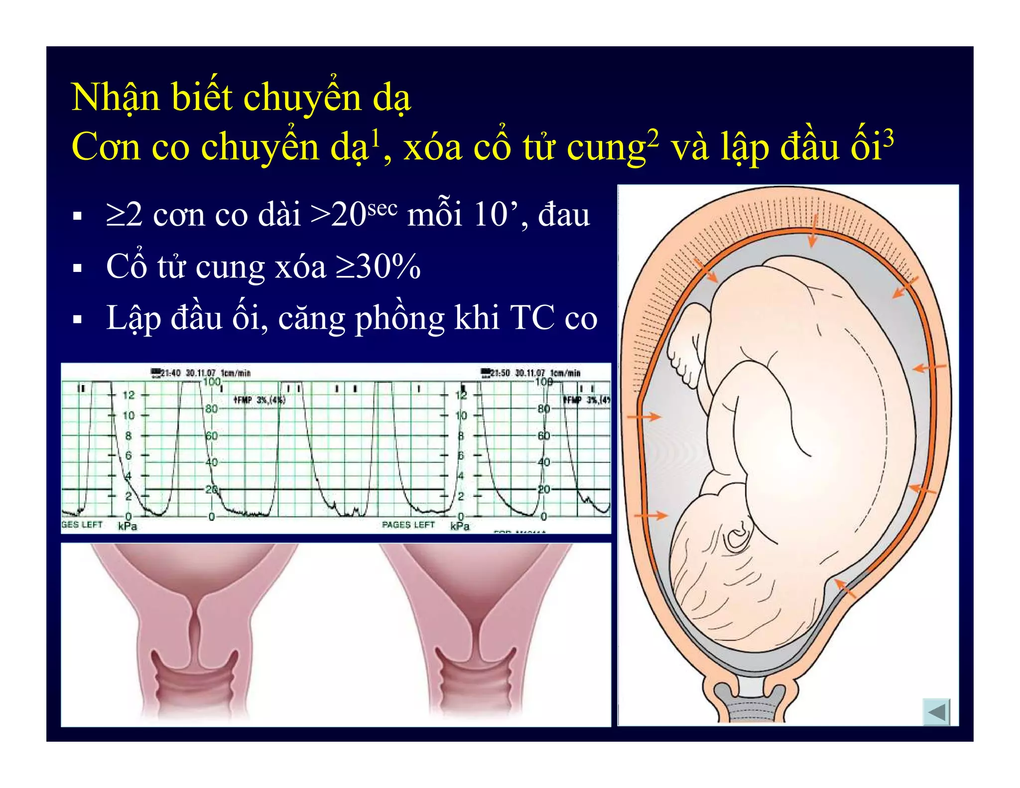 SINH LÝ CHUYỂN DẠ | PDF