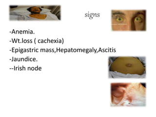 1 GASTRIC CANCER.pptx