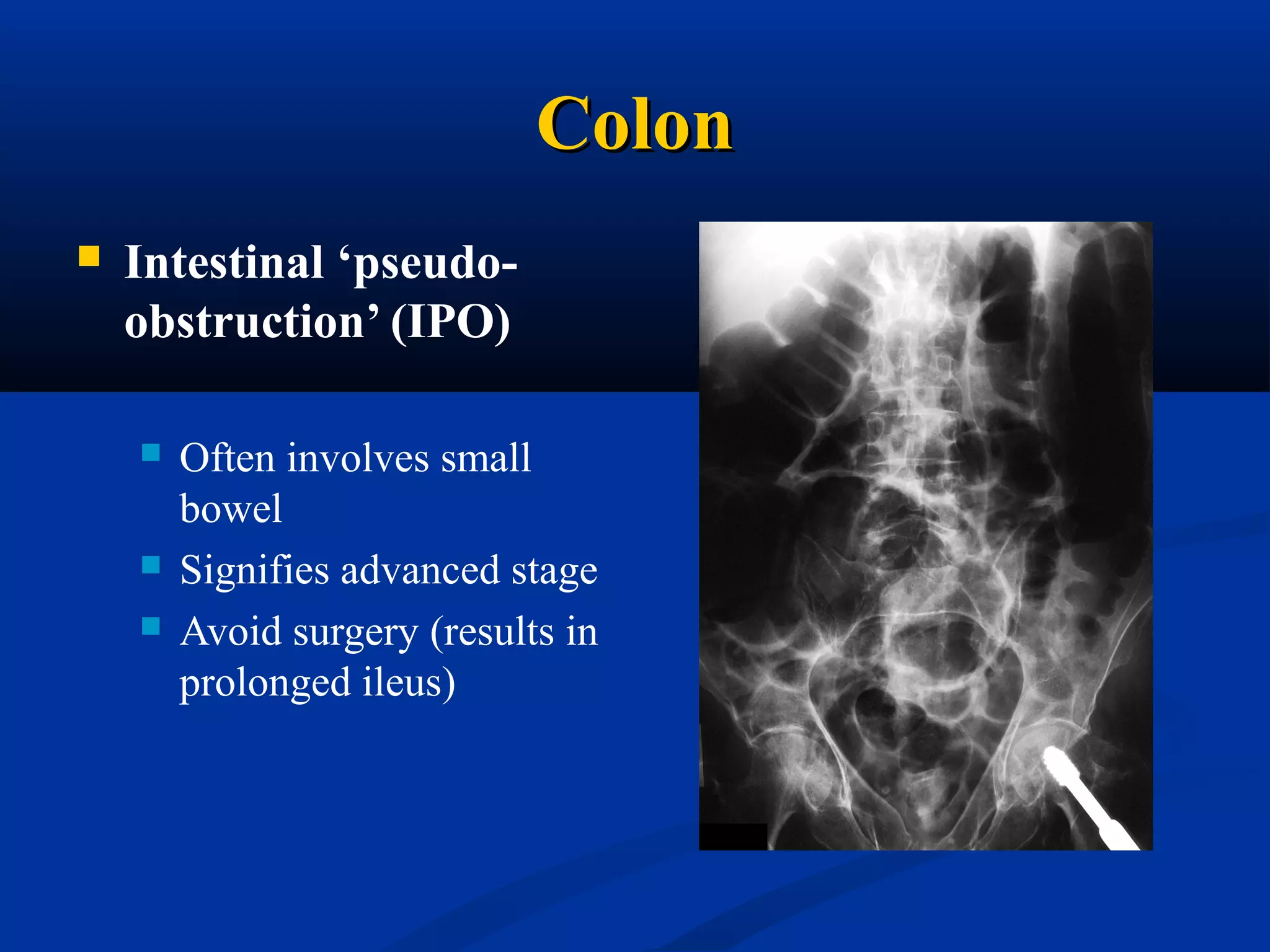 1 gastrointestinal manifestations of systemic sclerosis | PPT