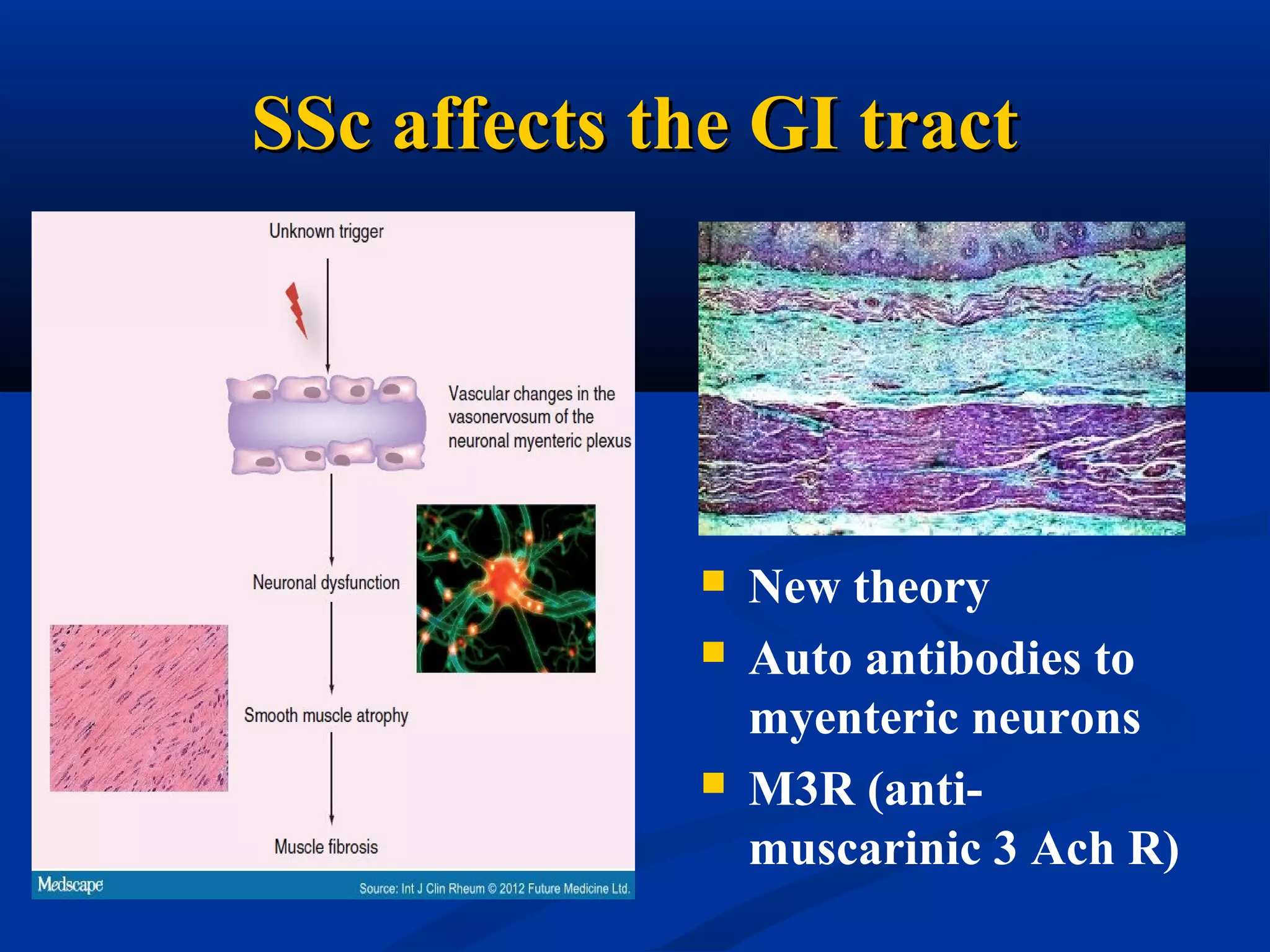 1 gastrointestinal manifestations of systemic sclerosis | PPT