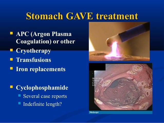 1 gastrointestinal manifestations of systemic sclerosis