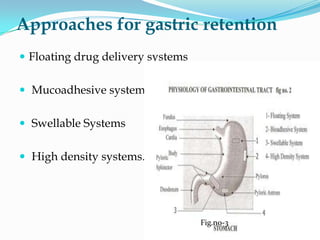 1 gastroretentive drug delivery systems | PPTX
