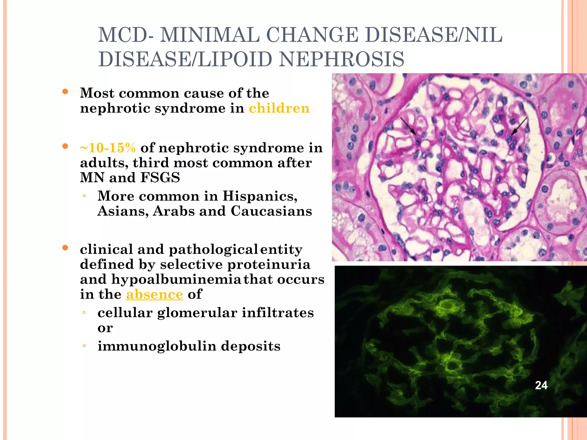 1 glomerular disease & anatomy pysiology of kideny | PPT