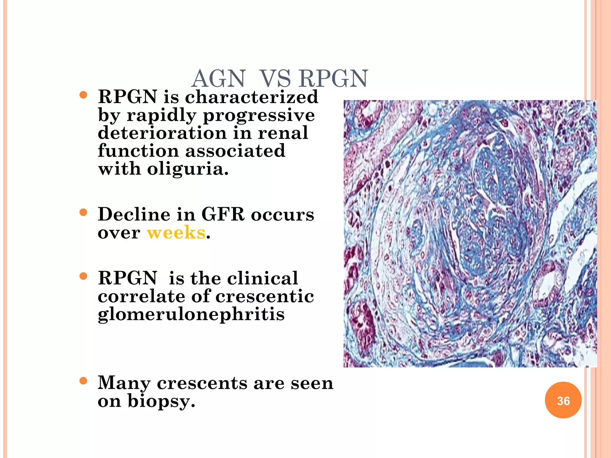 1 glomerular disease & anatomy pysiology of kideny | PPT