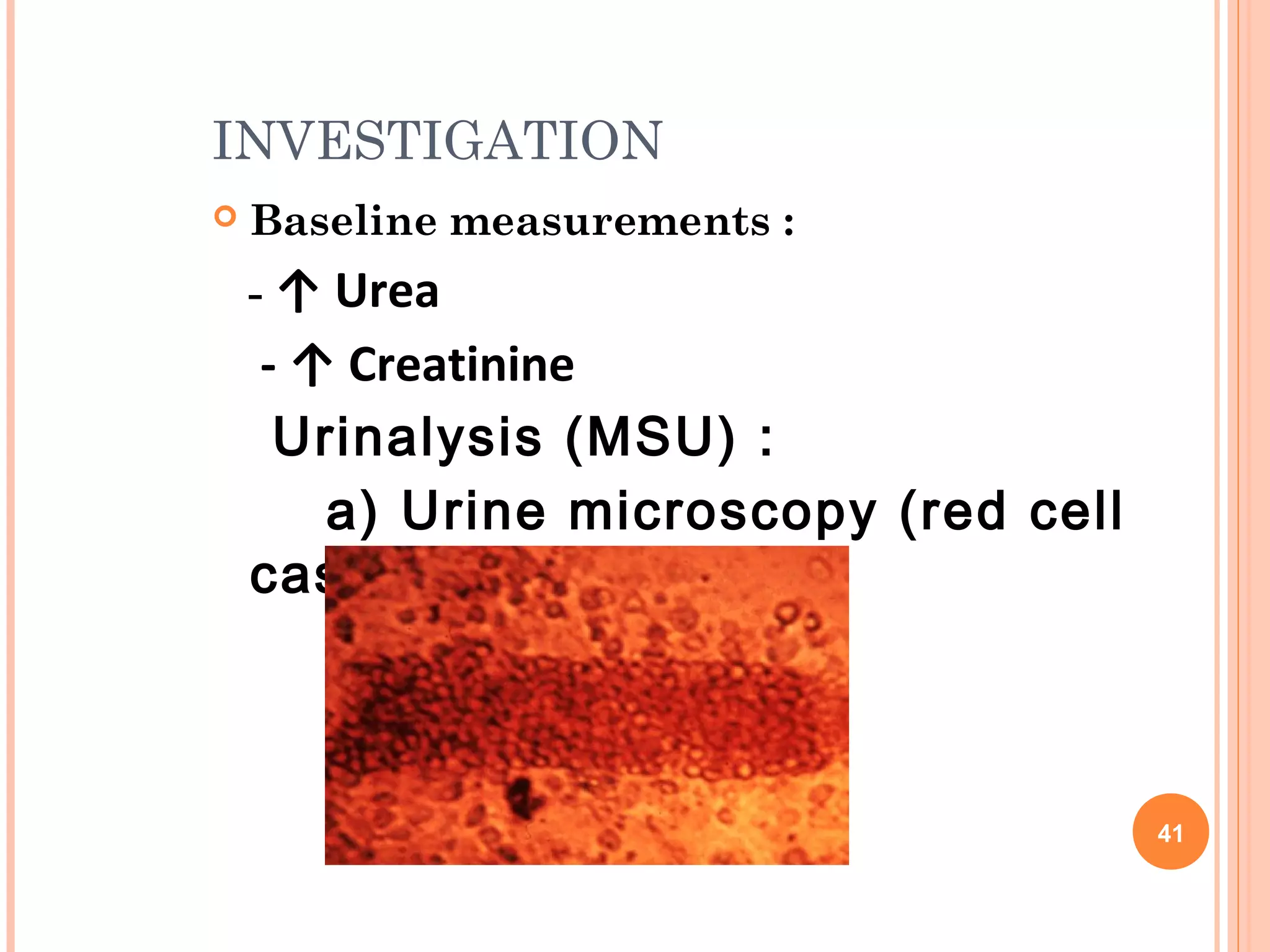 1 glomerular disease & anatomy pysiology of kideny | PPT
