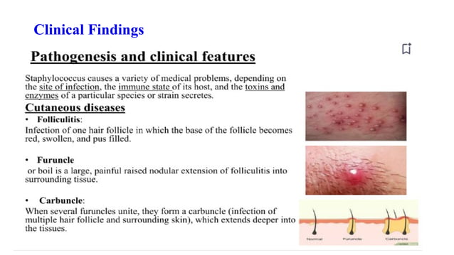 DPT - Microbiology II (Gram +ve cocci) - Genus Staphylococcus | PPT
