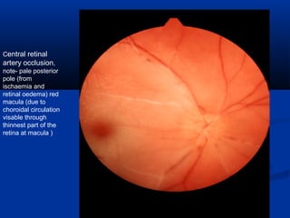 History taking in ophthalmology | PPT
