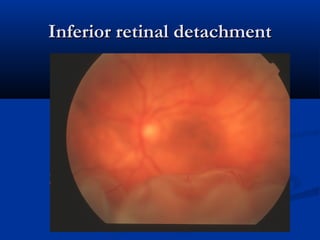 History taking in ophthalmology | PPT