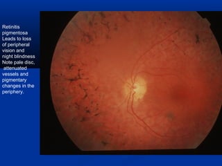 History taking in ophthalmology | PPT