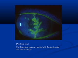 History taking in ophthalmology | PPT