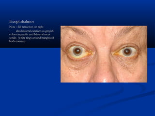 History taking in ophthalmology | PPT