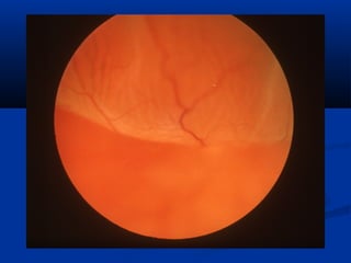 History taking in ophthalmology | PPT