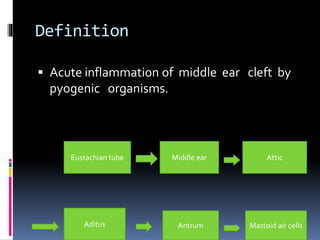 1 hour otitis media ,,.pptx