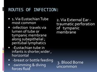 1 hour otitis media ,,.pptx