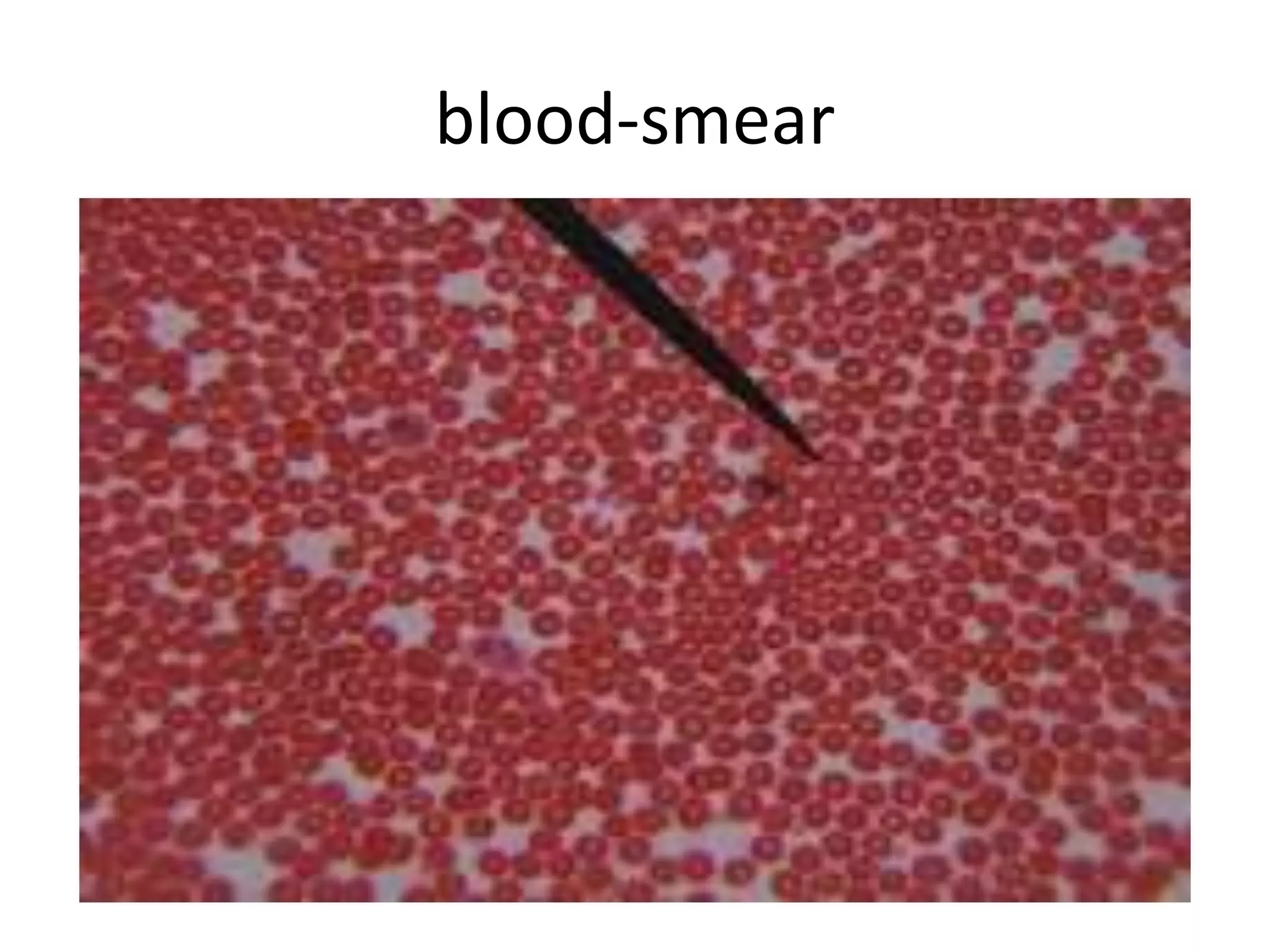 1 human blood, smear | PPTX