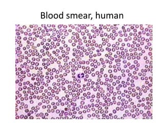 1 human blood, smear | PPTX