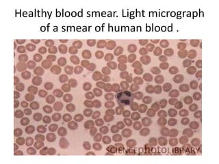 1 human blood, smear | PPTX